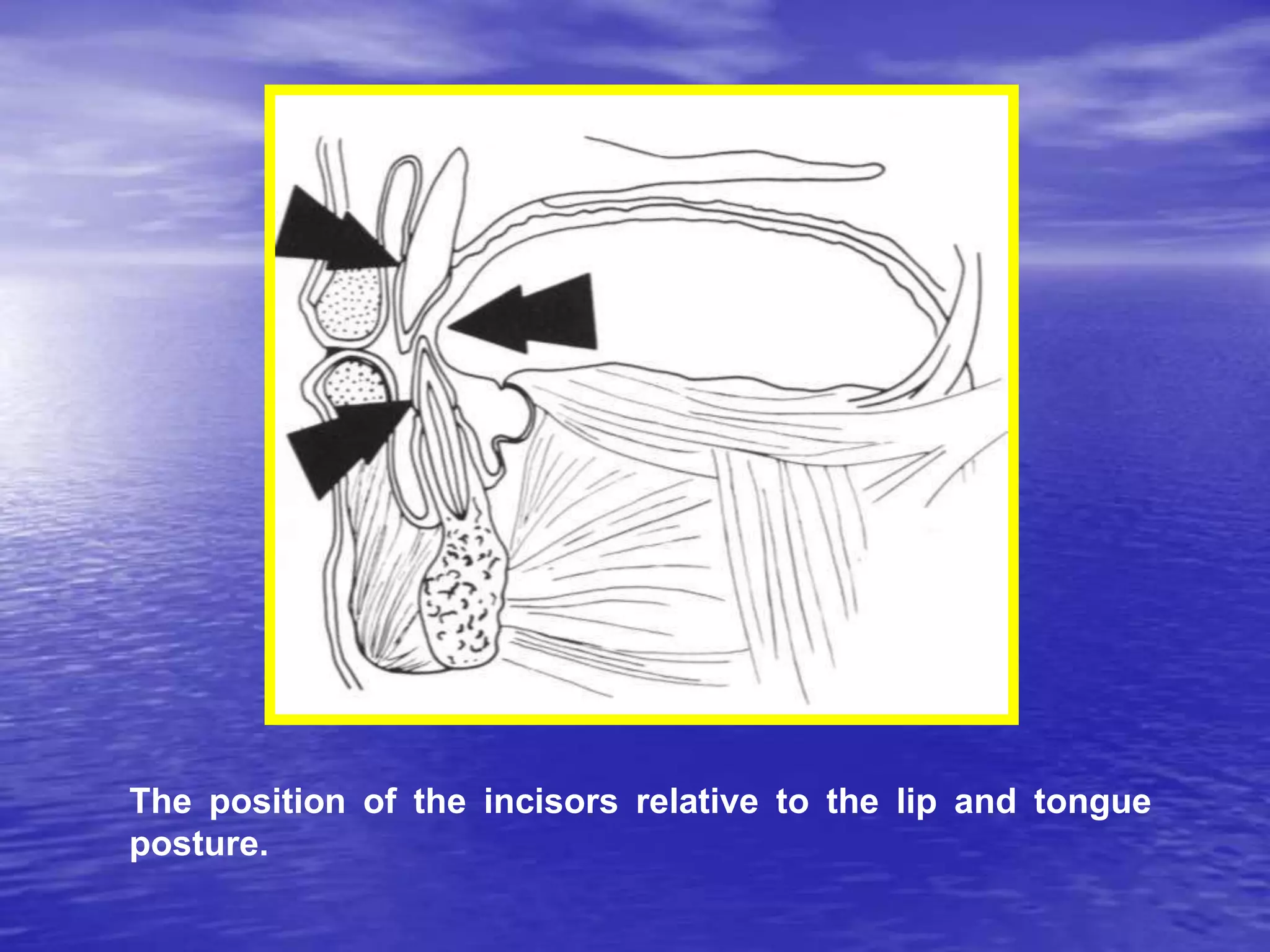 Development of normal dentition and occlusion | PPT
