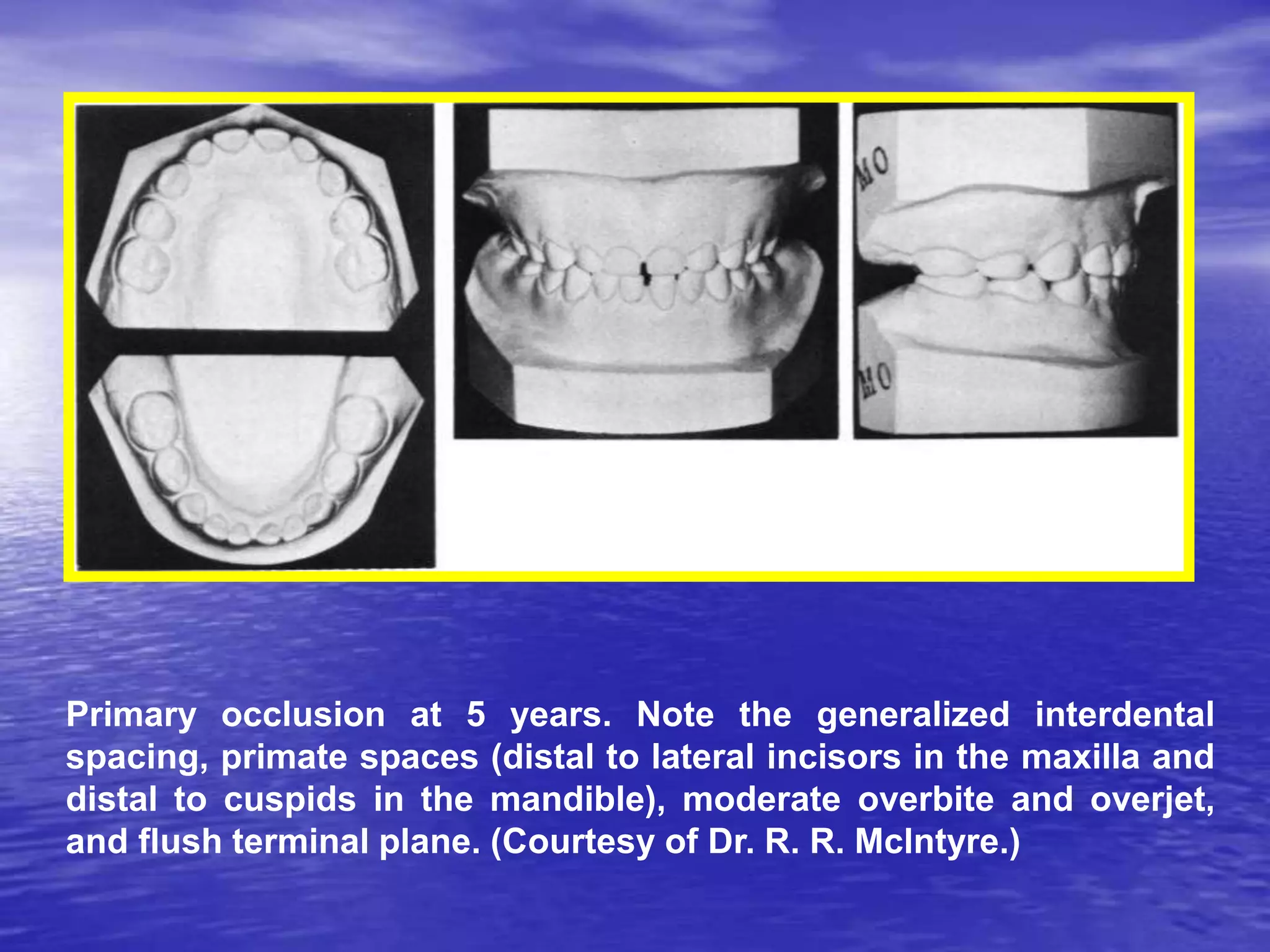 Development of normal dentition and occlusion | PPT