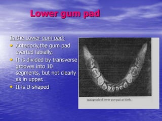 Development of normal dentition and occlusion | PPT
