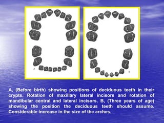 Development of normal dentition and occlusion | PPT