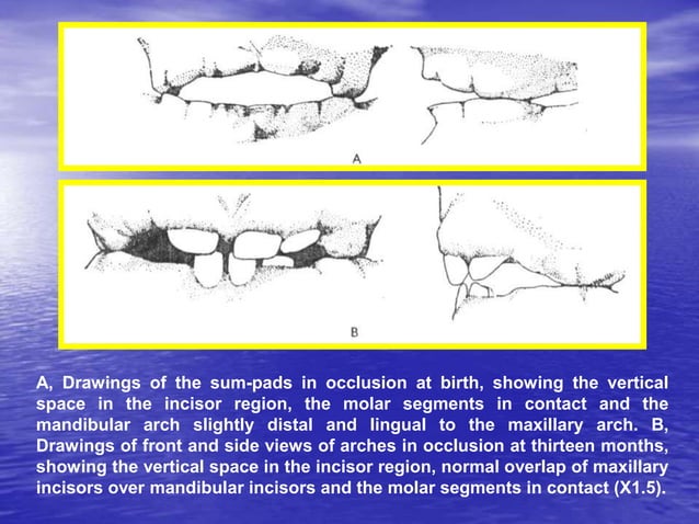 Development of normal dentition and occlusion | PPT