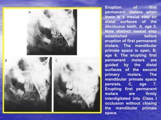 Development of normal dentition and occlusion | PPT