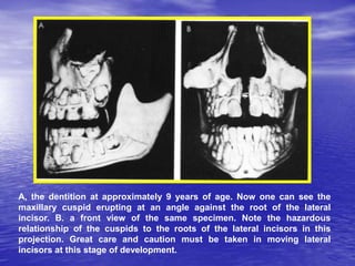 Development of normal dentition and occlusion | PPT