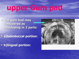 Development of normal dentition and occlusion | PPT