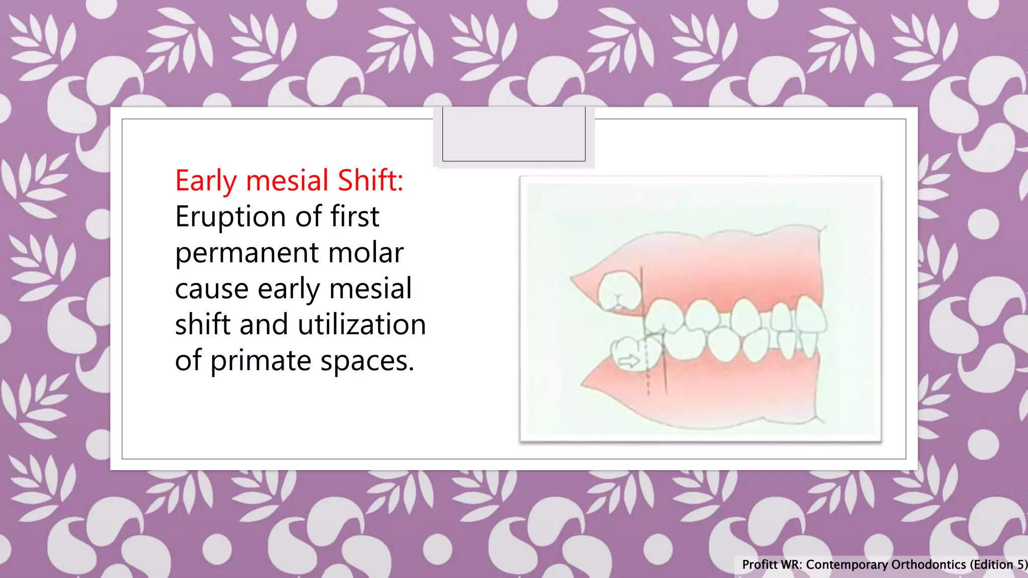 Development of normal occlusion | PPTX