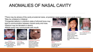 DEVELOPMENT OF NOSE, PARANASAL SINUS, p (1).pptx