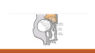 DEVELOPMENT OF NOSE, PARANASAL SINUS, p (1).pptx