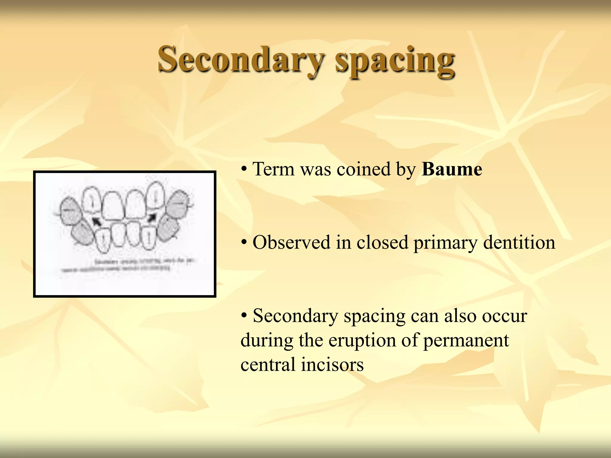 Development of occlusion. | PPTX