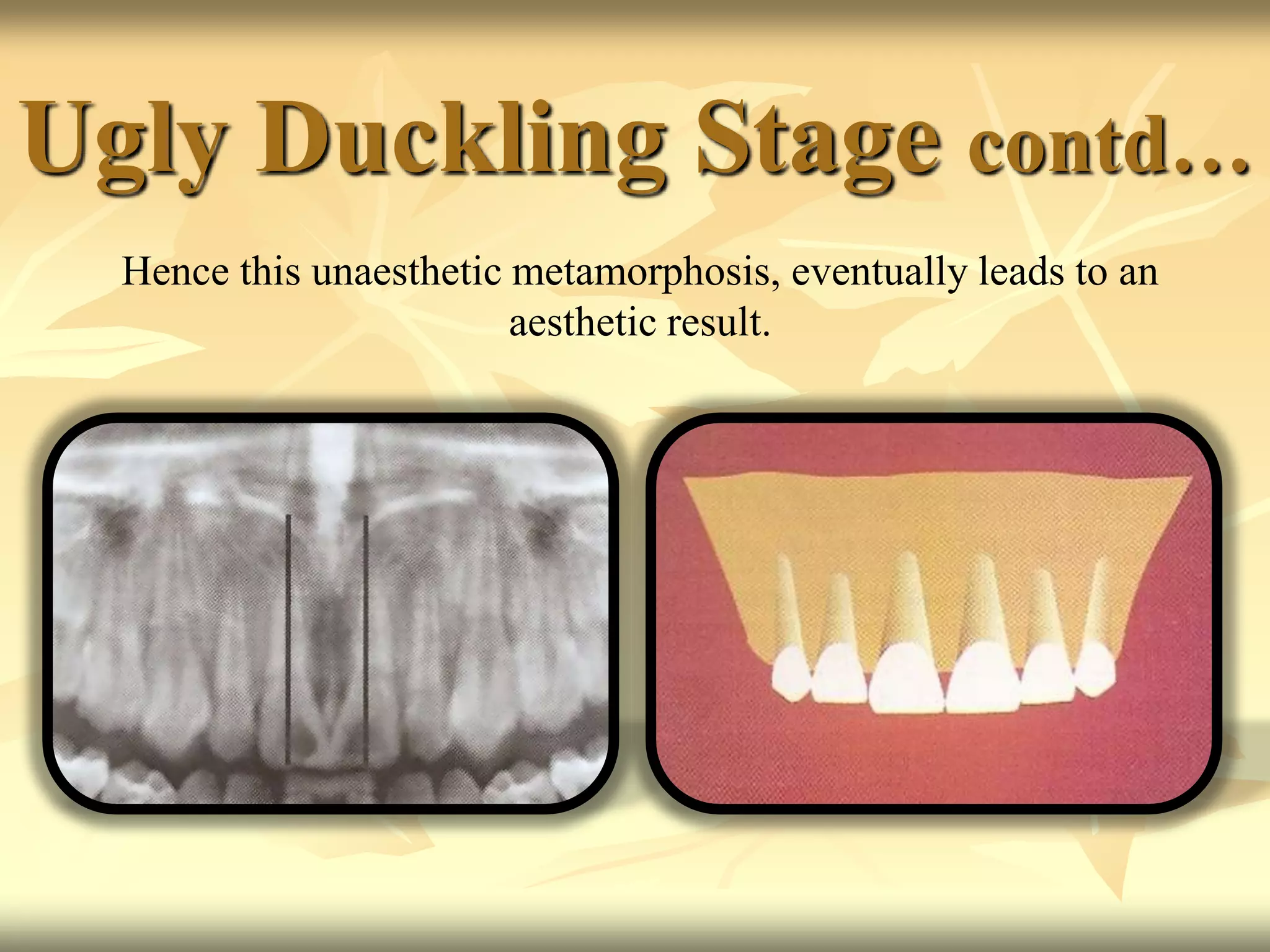 Development of occlusion. | PPTX