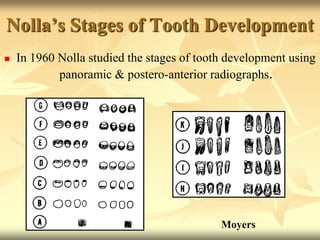 Development of occlusion. | PPTX