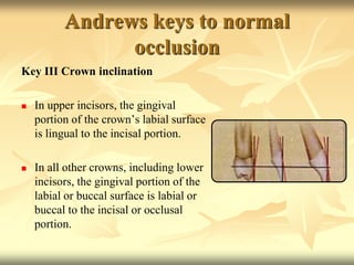Development of occlusion. | PPTX