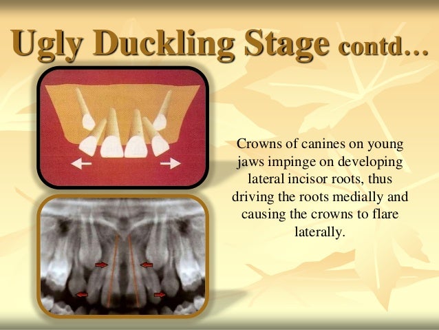 Development of occlusion.
