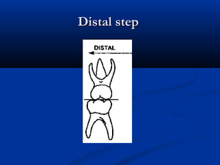 Development of occlusion | PPT