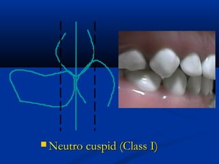 Development of occlusion | PPT