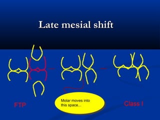 Development of occlusion | PPT