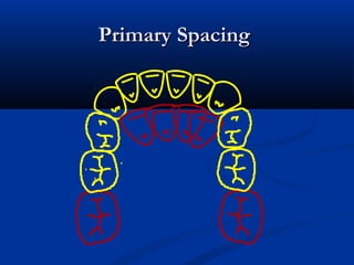 Development of occlusion | PPT