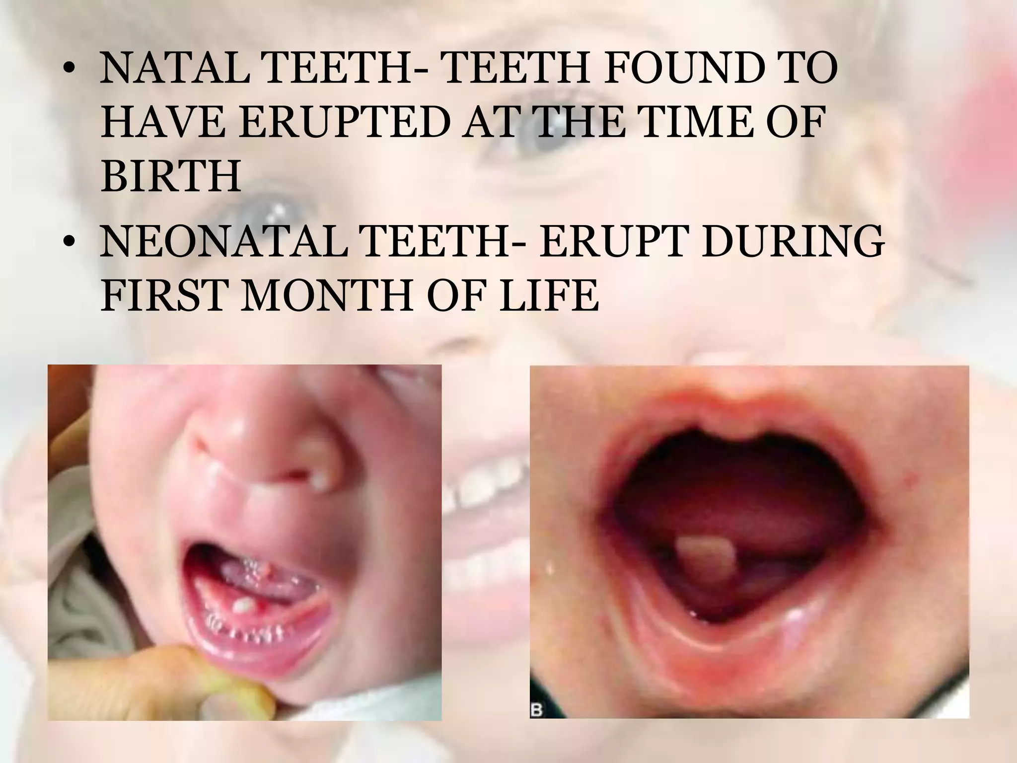 Development of occlusion | PPTX