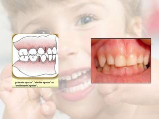 Development of occlusion | PPTX