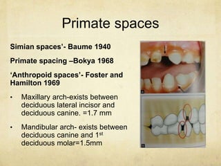 Development of occlusion | PPT
