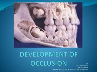 Development of occlusion | PPT