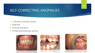 Developmensssssssssssssssssssssst of occlusion.pptx