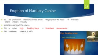 Developmensssssssssssssssssssssst of occlusion.pptx