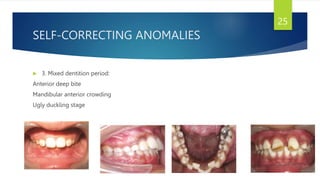 Developmensssssssssssssssssssssst of occlusion.pptx