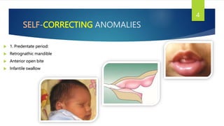 Developmensssssssssssssssssssssst of occlusion.pptx