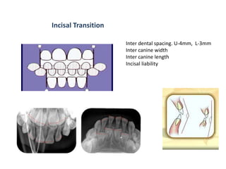 Development of Occlusion from infancy to adolescence. PPT | PPTX ...