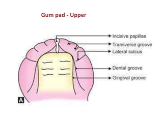 Development of Occlusion from infancy to adolescence. PPT | PPTX ...