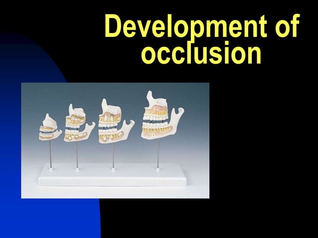 DEVELOPMENT OF OCCLUSION - final.ppt | Dental Health | Diseases and ...