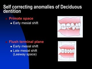 DEVELOPMENT OF OCCLUSION - final.ppt