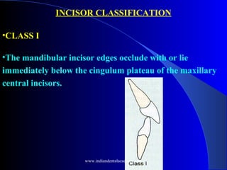 Development of occlusion | PPT