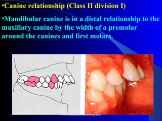 Development of occlusion | PPT