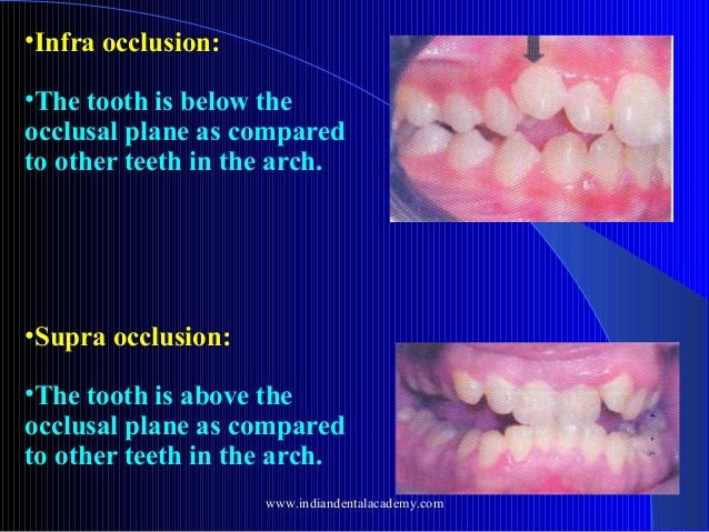 Development of occlusion