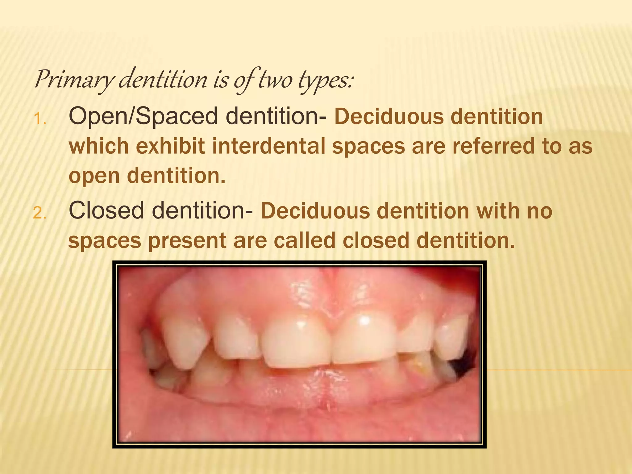 Development of occlusion from birth to primary dentition.pptx