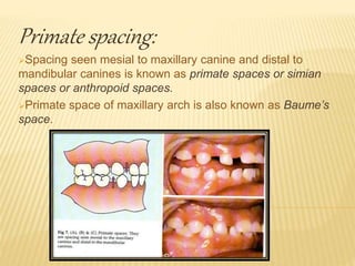 Development of occlusion from birth to primary dentition.pptx