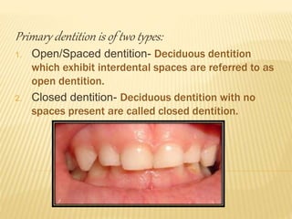 Development of occlusion from birth to primary dentition.pptx