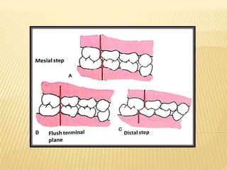 Development of occlusion from birth to primary dentition.pptx