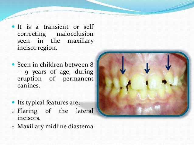 Occluded Front Definition For Kids