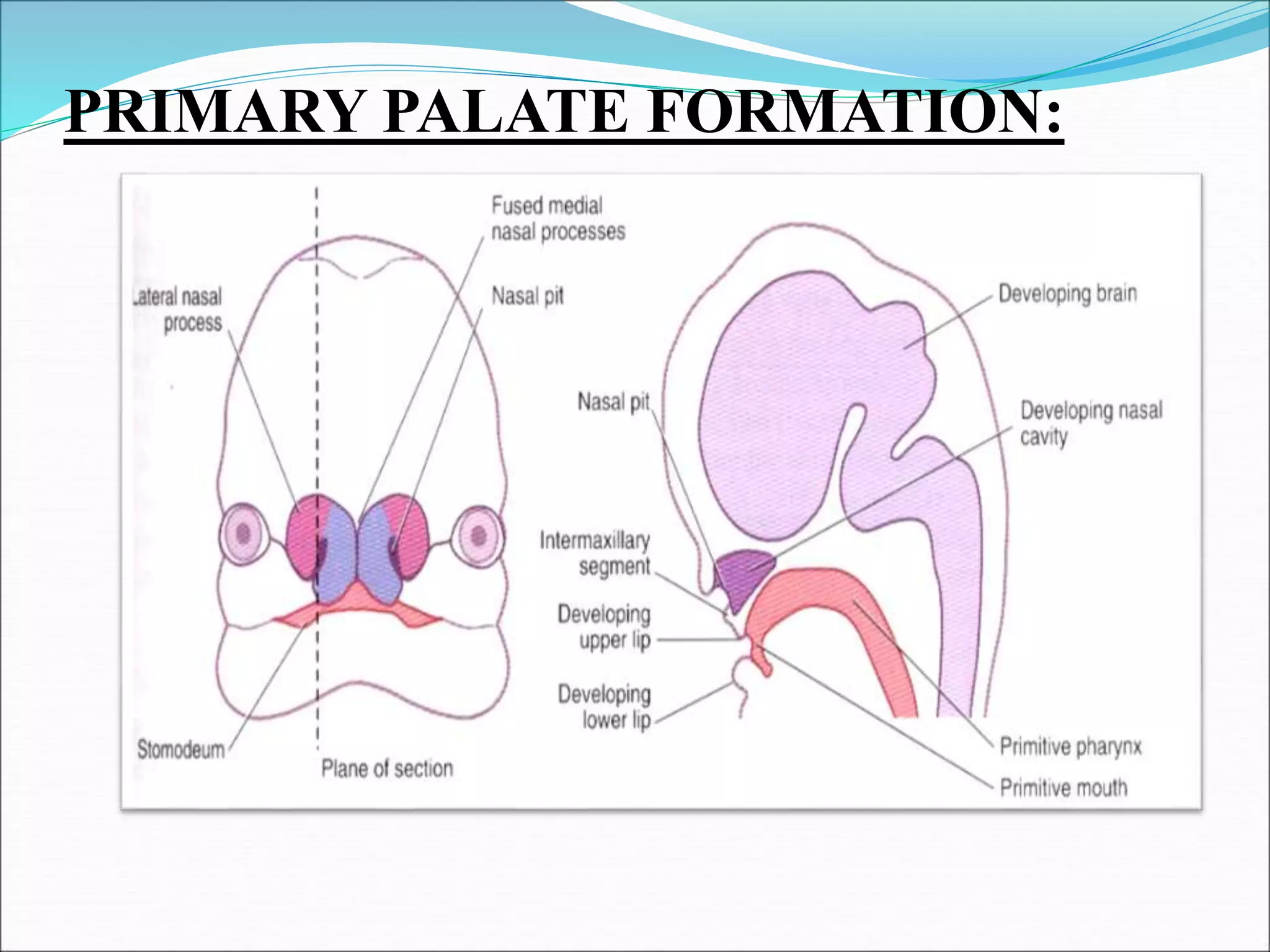 DEVELOPMENT OF PALATE.ppt