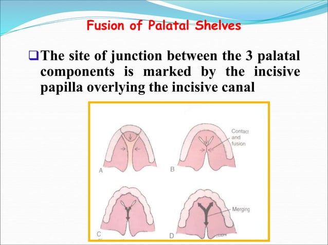 DEVELOPMENT OF PALATE.ppt