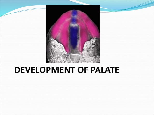 DEVELOPMENT OF PALATE.ppt