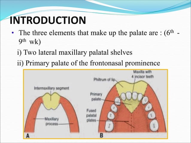 DEVELOPMENT OF PALATE.ppt