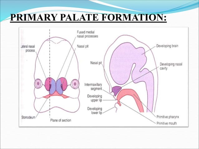 DEVELOPMENT OF PALATE.ppt