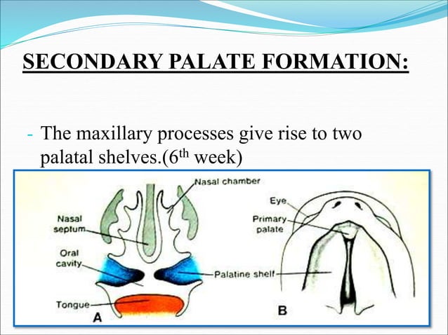 DEVELOPMENT OF PALATE.ppt