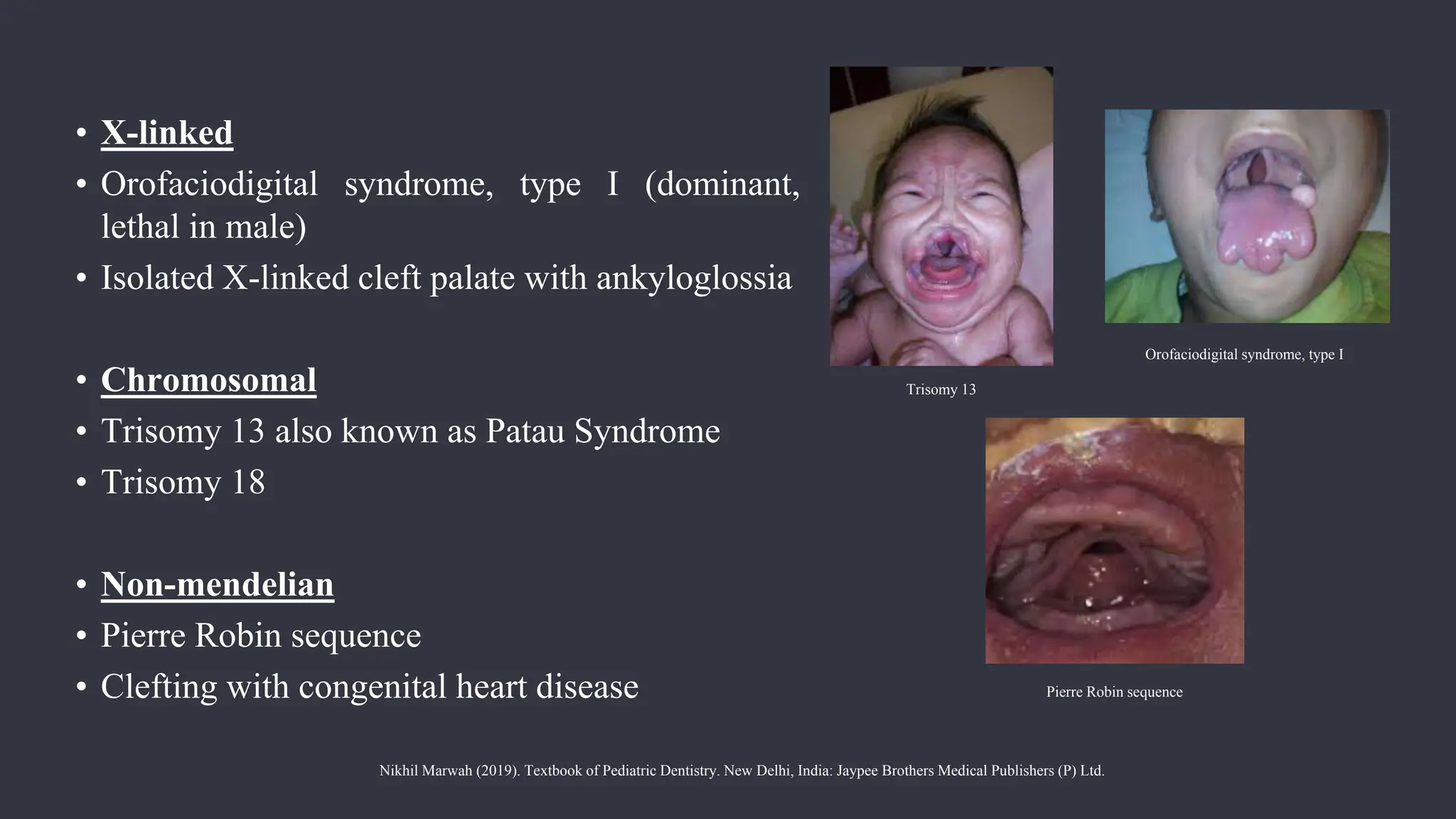 Development of Palate and its Anamolies.pptx
