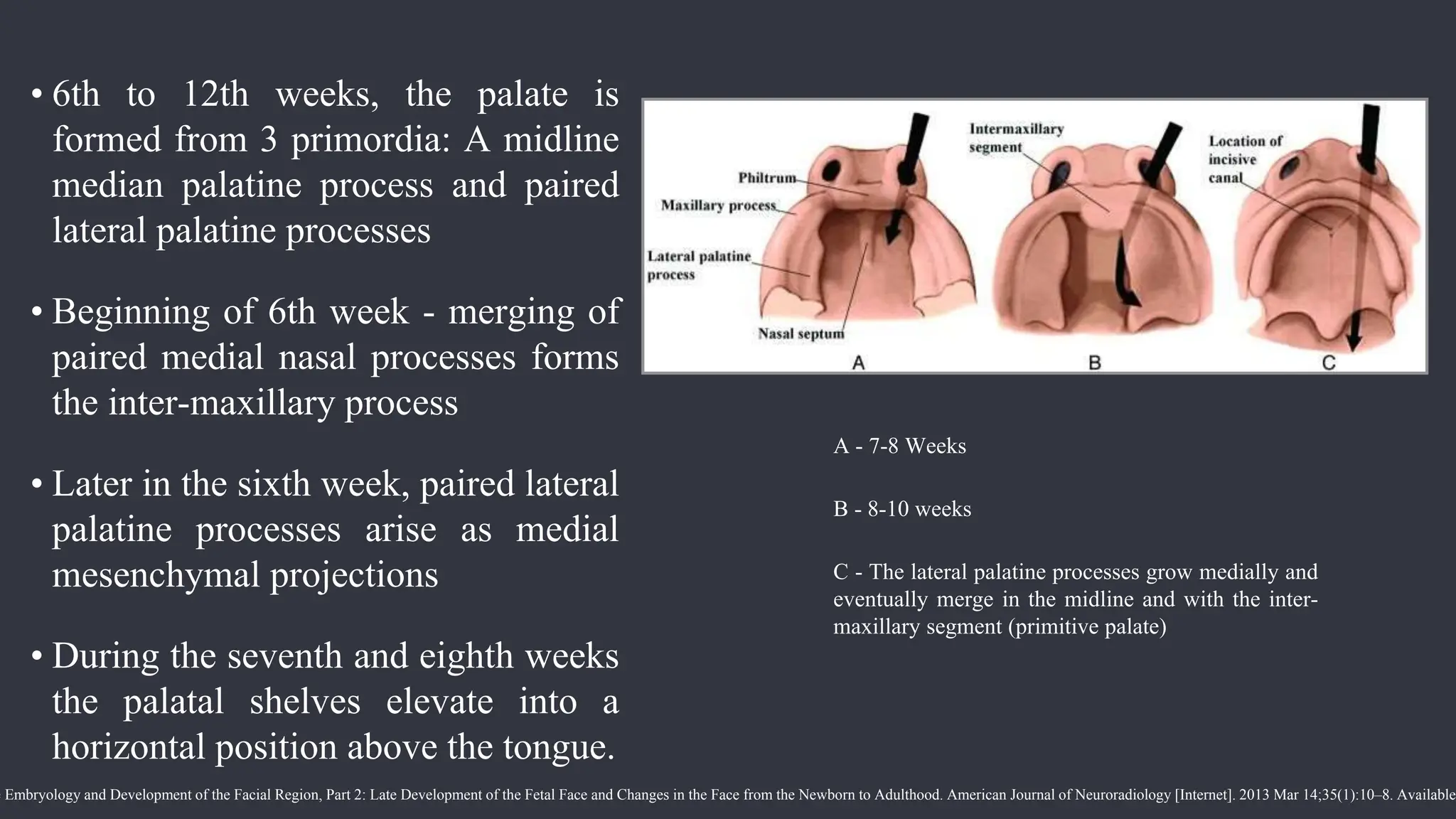 Development of Palate and its Anamolies.pptx