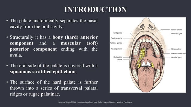 Development of Palate and its Anamolies.pptx | Dental Health | Diseases ...