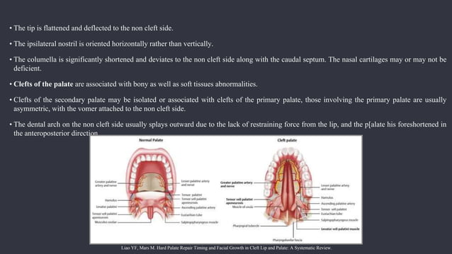 Development of Palate and its Anamolies.pptx | Dental Health | Diseases ...